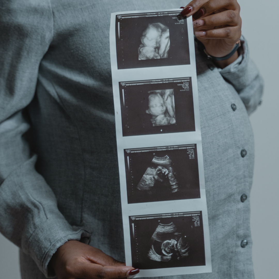Multi-Generational Samples Allow Researchers to Search for Link Between ...